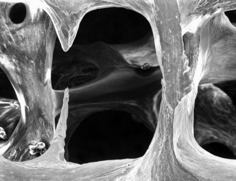 Scintigrafie odhalí nádory a podá zprávu o stavu... | Léčba rakoviny